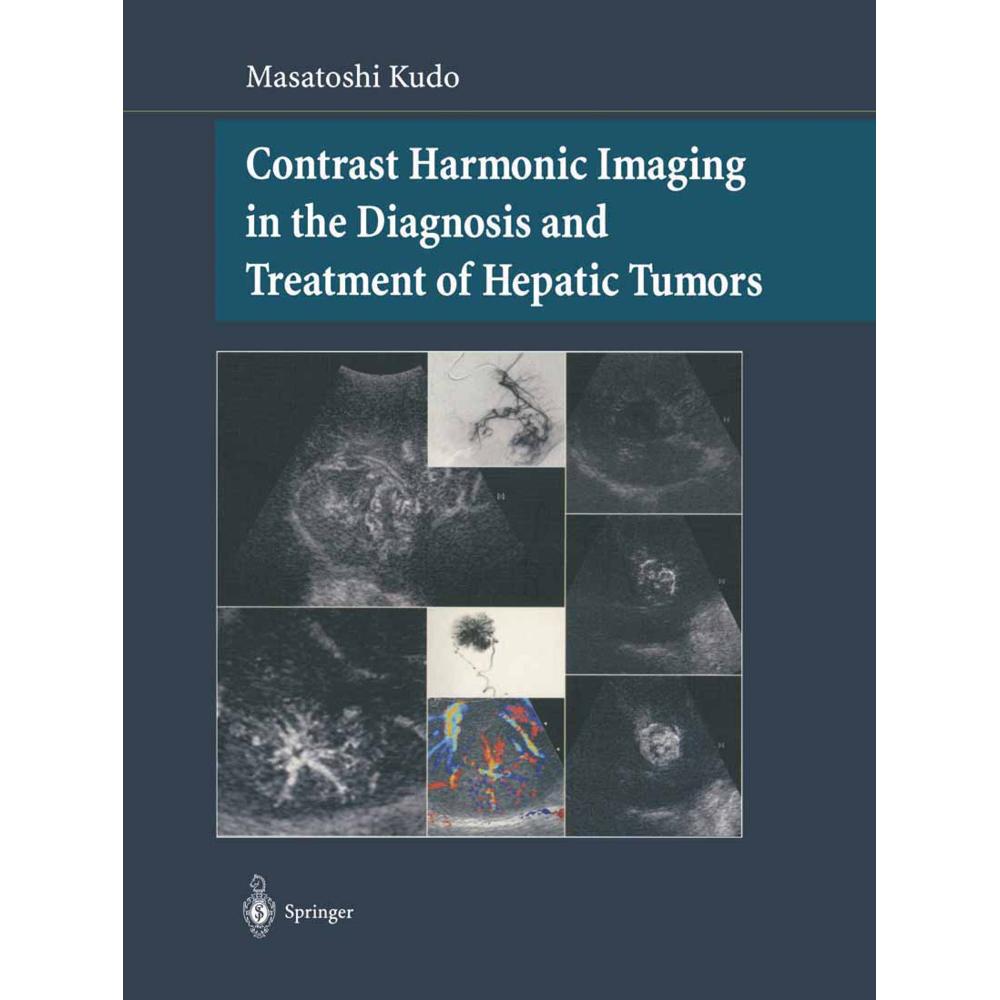 Springer Contrast Harmonic Imaging in the Diagnosis and Treatment of ...
